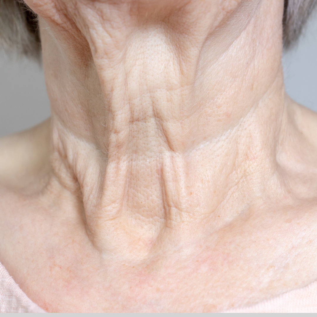 Neck and Décolletage concerns | SAM Clinic